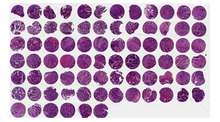 Kidney Tissue Microarray (TMA) Dot: 32 Case: 32 per slide - BIOTANG Inc ...